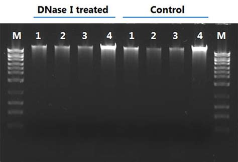 Phage Dna Isolation Kit 46800