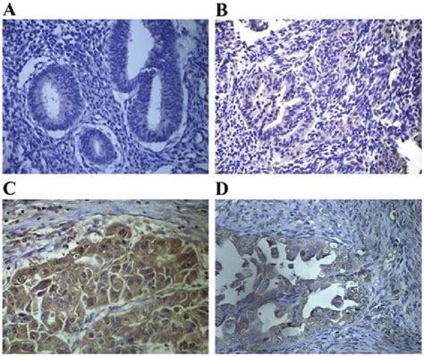 Oncostatin M OSM Expression In Human Endometrial Tissue Specimens