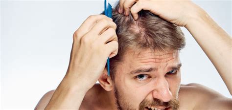 ما سبب تساقط الشعر؟ Clinicexpert خدمات زراعة الشعر والرعاية الصحية