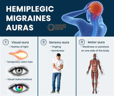 How Long Does It Take To Recover From A Hemiplegic Migraine Health Blog