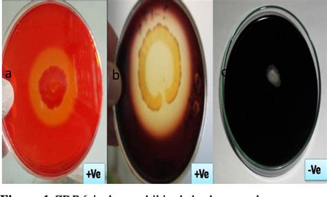 Figure 1 From Isolation And Identification Of Cellulose Degrading
