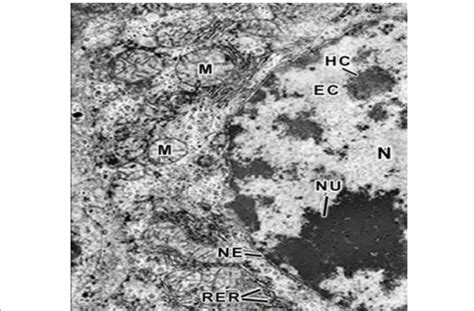 An Electron Micrograph Of A Hepatocyte Showing The Rough Endoplasmic