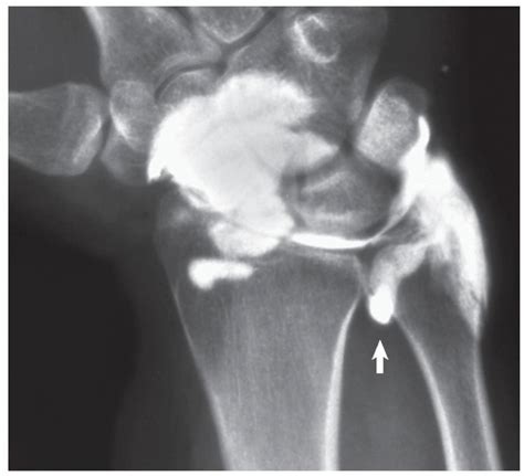 Imaging Techniques In Orthopaedics Radiology Key