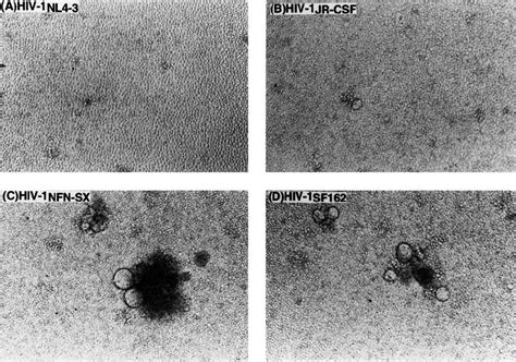 Generation Of Syncytia In Clonal Cd4 ϩ Th1 Cells By Infection With