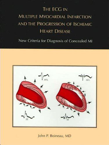 the ecg in multiple myocardial infarction and the 9780976400509 books