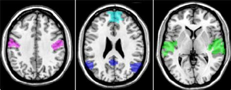 synthetic data results a 42 scans as in real data b idealistic