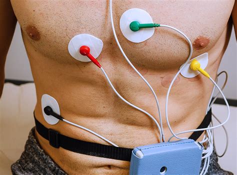 Monitorizarea Holter A Ritmului Cardiac Monitorizare Holter ECG Arterra