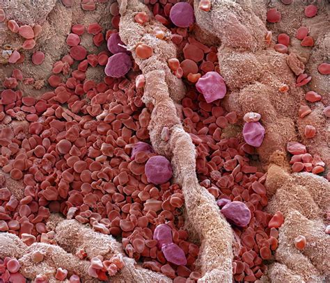 Amnion Sem Stock Image F0437776 Science Photo Library