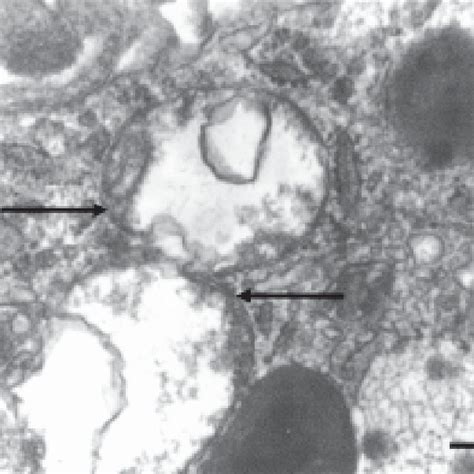 Invagination Of The Cell Membrane Following Virus Attachment Arrow A