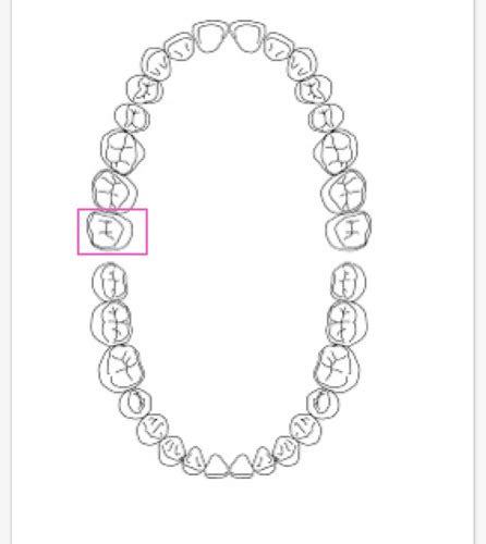 Tooth Numbering Flashcards Quizlet
