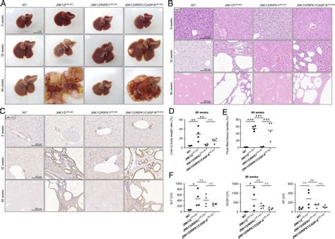 Jnk Signaling Prevents Biliary Cyst Formation Through A Caspase 8
