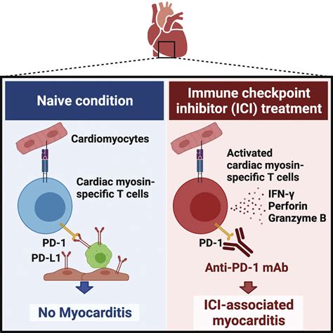 Cardiac Myosin Specific Autoimmune T Cells Contribute To Immune