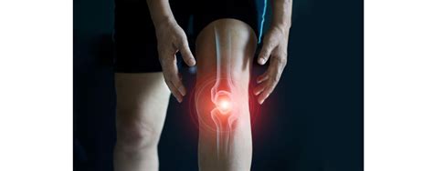 The Use Of Curved Implants In Pelvic Ring Surgery Early Positive