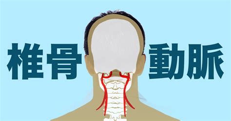 首の後ろの痛みと脳梗塞の関係について 再生医療 脳梗塞脊髄損傷の幹細胞治療 ニューロテックメディカル