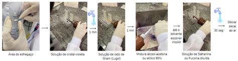 Coloração De Gram