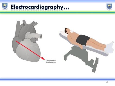 Cardiovascular Testing Ppt