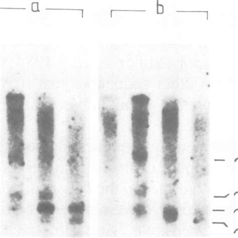 Mapping Of Dnase I Hypersensitive Sites In The 5 Region Of The Mouse Download Scientific
