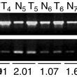 Nucleophosmin Expression Was Detected In Clinical Samples With HCC By