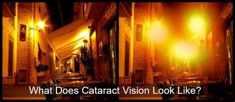 What Does Cataracts Vision Look Like At Night Banner Ethosvision