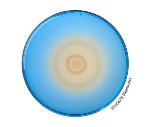 Sesame Salmonella Test® Biokar Diagnostics