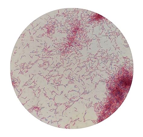 Bacillus Cereus Simple Stain