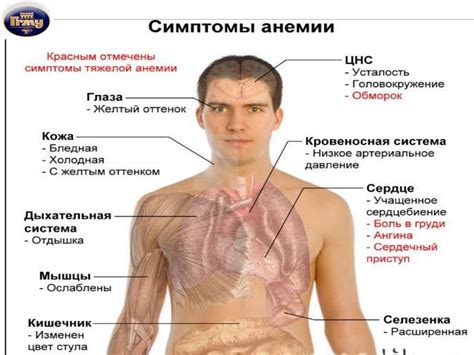 Диагностика и лечение анемии - презентация онлайн