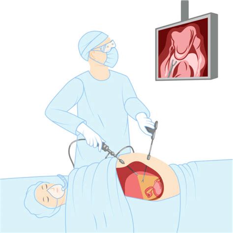 1800 Laparoscopic Surgery Stock Illustrations Royalty Free Vector