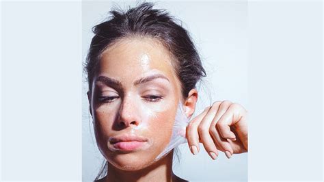 Chemical Peels