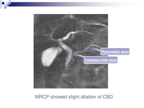 Ppt Biliary System Powerpoint Presentation Free Download Id 9184215