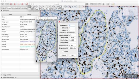Working With Imagej · Qupathqupath Wiki · Github