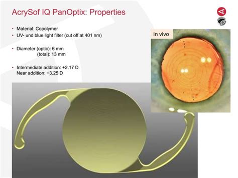 New Versus Former Generation Diffractive Trifocal Intraocular Lens Pptx Physics Science