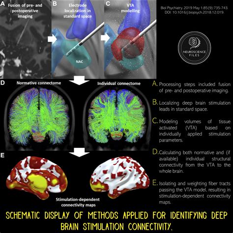 Ocd Brain Mri Brain Differences In How Obsessive Compulsive Patients