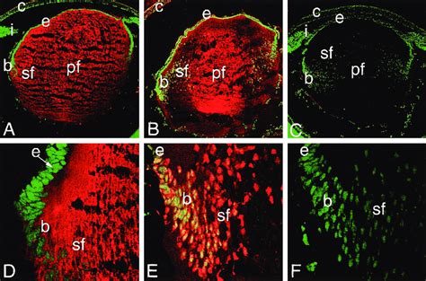 Confocal Micrographs Of Newborn Mouse Lens Showing Immunohistochemical
