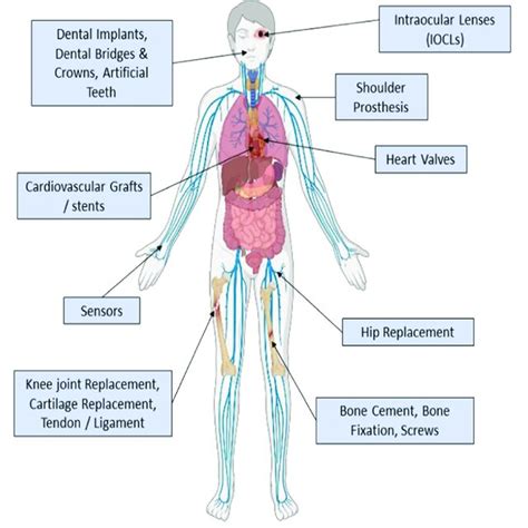 Schematic Of Applications Of Biomaterials In The Human Body Download