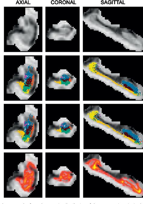 Figure 1 From Improved Inference In Bayesian Segmentation Using Monte