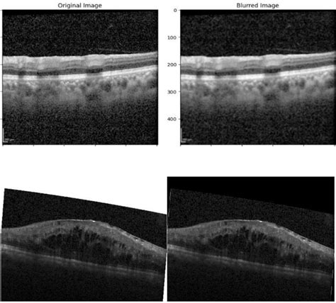 论文审查 Ophthalmic Biomarker Detection With Parallel Prediction Of Transformer And Convolutional