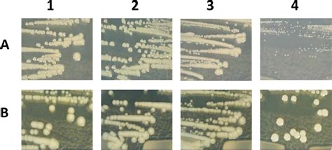 E Coli Plate Morphology