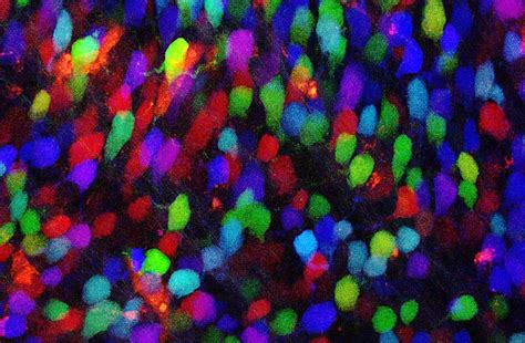 Neurogenesis And Circuit Development Institut De La Vision