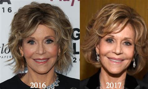 Jane Fonda Plastic Surgery Before And After Photos Plastic Surgery