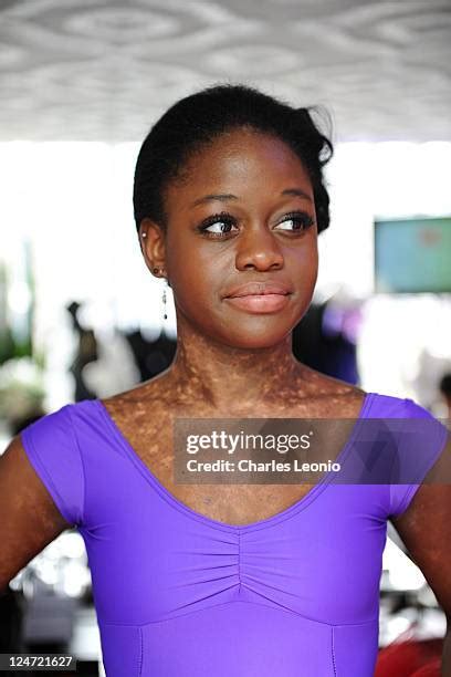 Michaela De Prince Photos And Premium High Res Pictures Getty Images