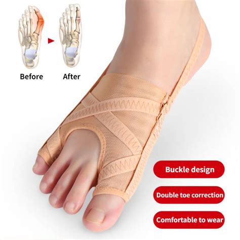 Thumb Eversion Little Toe Varus Toe Orthosis Toe Separation Orthosis