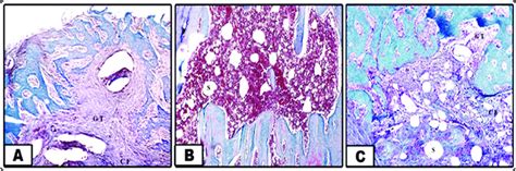 Masson × 100 Photograph After 2 Weeks A Control Bone Cavity After 2