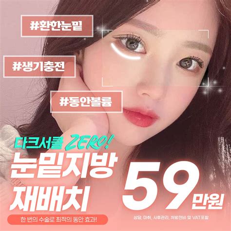 다크서클zer 눈밑지방재배치 By 플레저성형외과의원 강남언니 1등 성형수술and피부시술 정보앱