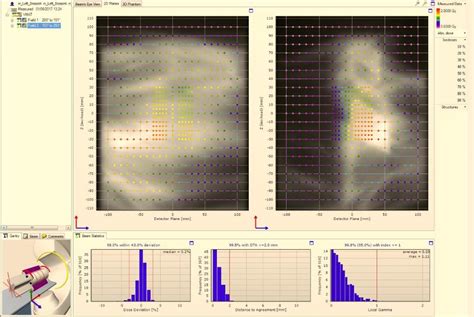 6 The Results Of The Delivery Of Vmat Plan Of The Second Field Of The