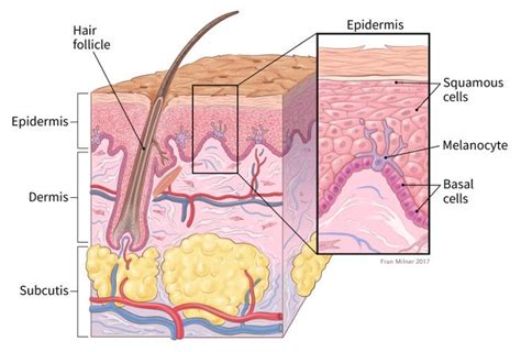 What Are Basal And Squamous Cell Skin Cancers Types Of Skin Cancer