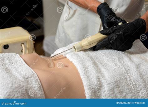 Female Receiving An Aesthetic Treatment With Radio Frequency Technique At An Aesthetic Center