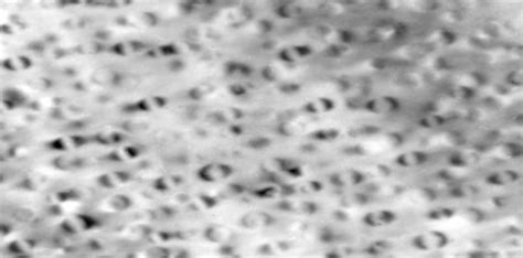 Alloy Microstructure After Solution Heat Treatment And Ageing At