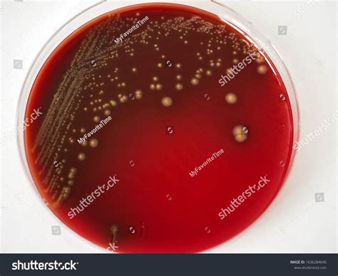 Alpha Hemolytic Strep On Bao
