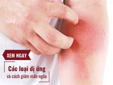 T Ng Quan V C C Lo I D Ng V C Ch Gi M M N Ng A Kh Ch U