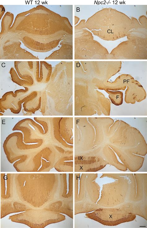 Cerebellar Purkinje Cell Degeneration In 12 Weeks Old Npc2 Mice